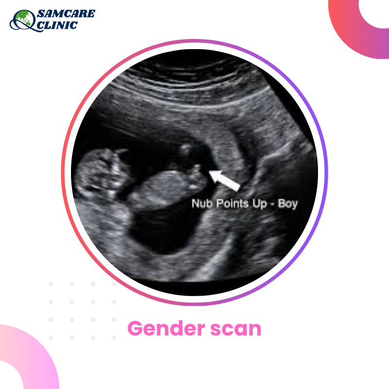 Gender scan - samcareclinic.com
